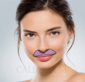 Depilación Láser - Bozo | Spa, Depilación Láser y Masajes en Monterrey